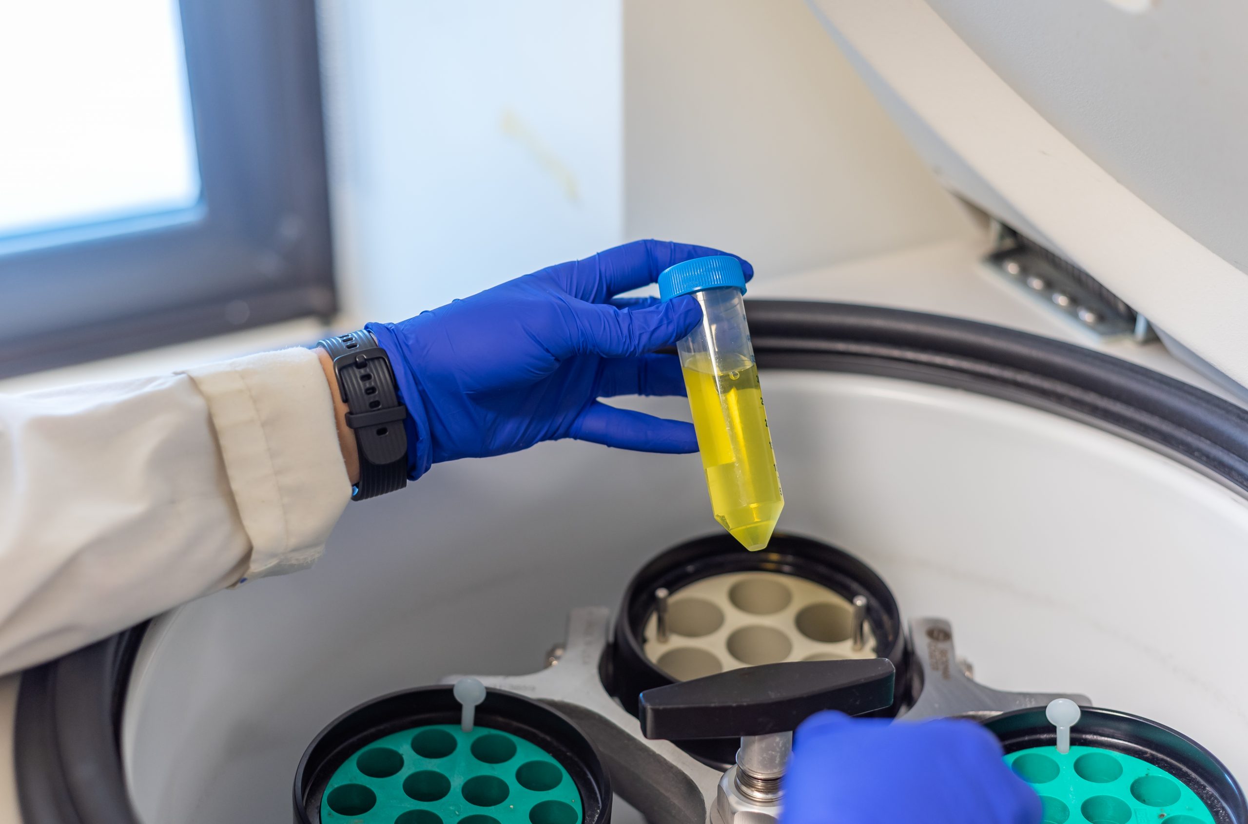 What is a centrifuge? - Kalstein